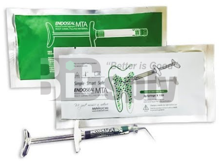 Root Can Filling Material- Endoseal MTA – Bigsply